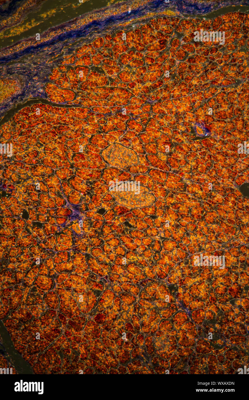 Cross section of pancreas hi-res stock photography and images - Alamy