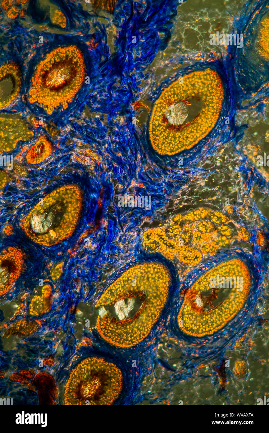Scalp with hair roots under the microscope 100x Stock Photo - Alamy