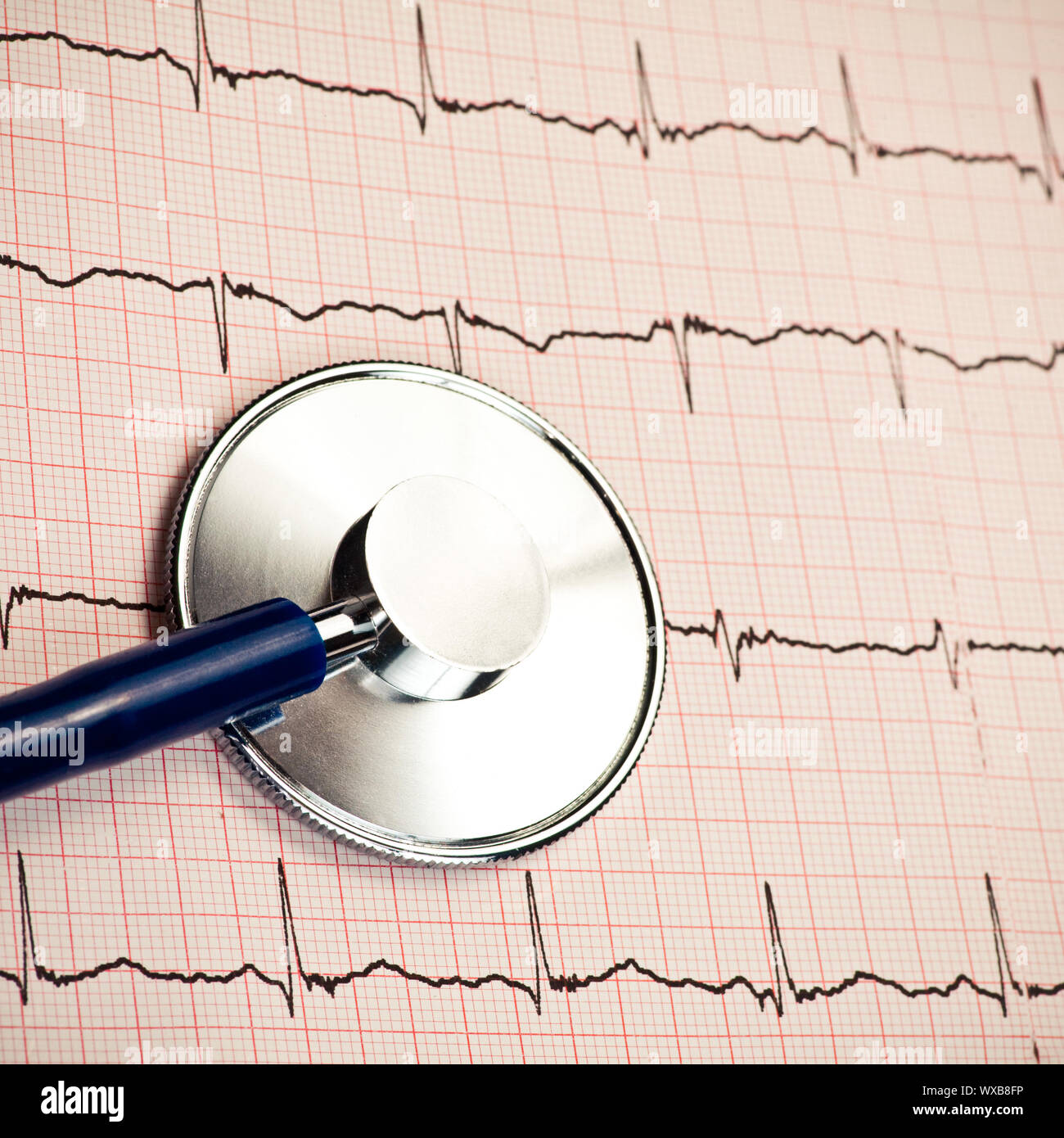 Stethoscope lying on ECG diagram Stock Photo - Alamy