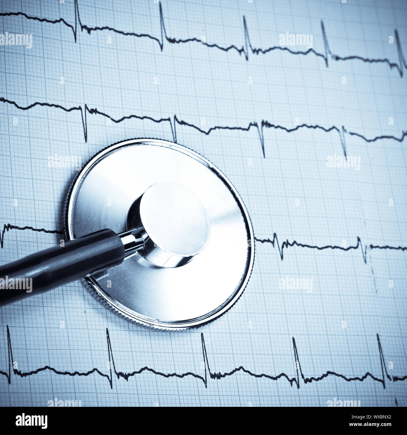 Stethoscope lying on ECG diagram Stock Photo - Alamy