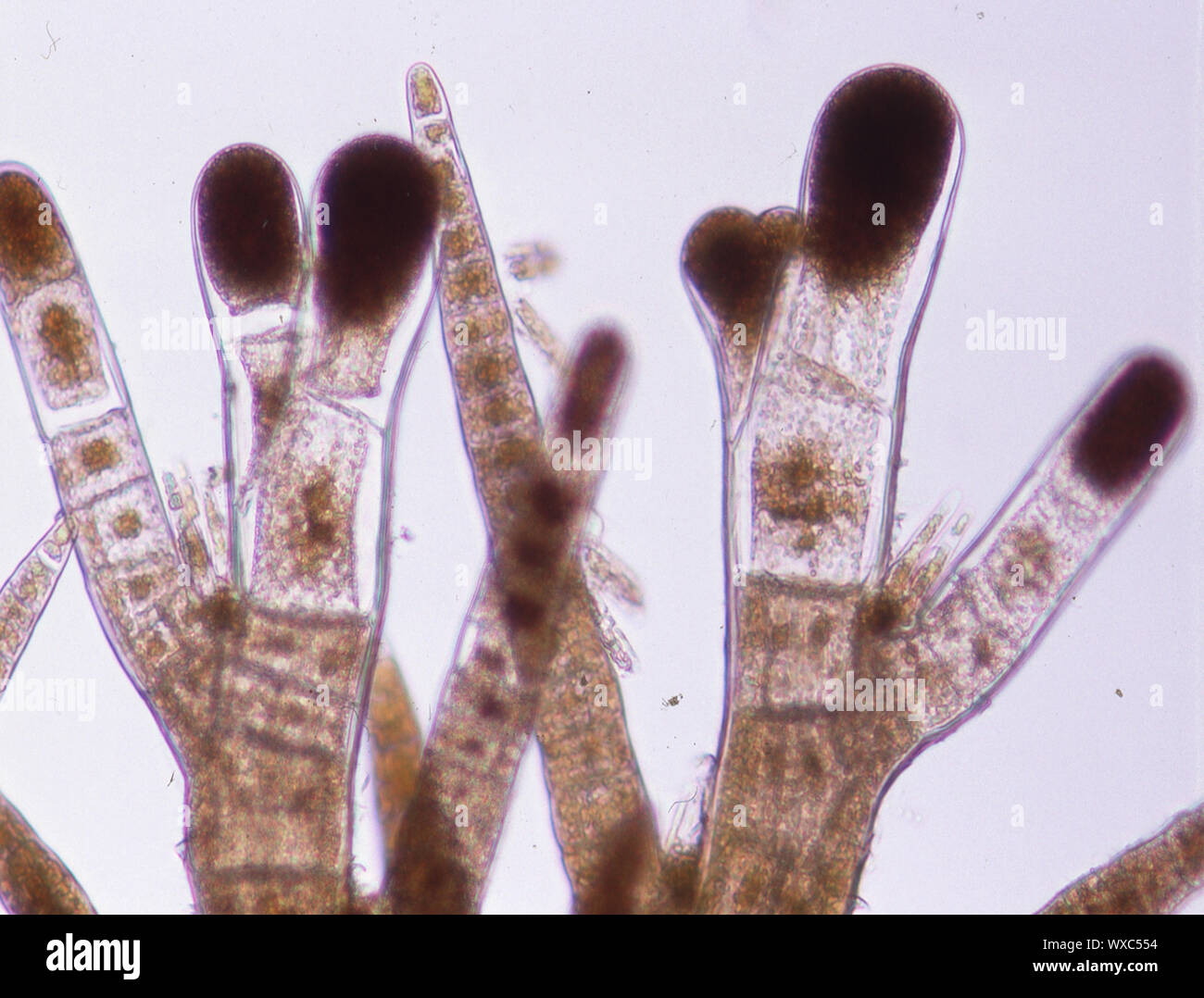 Red Algae Under Microscope