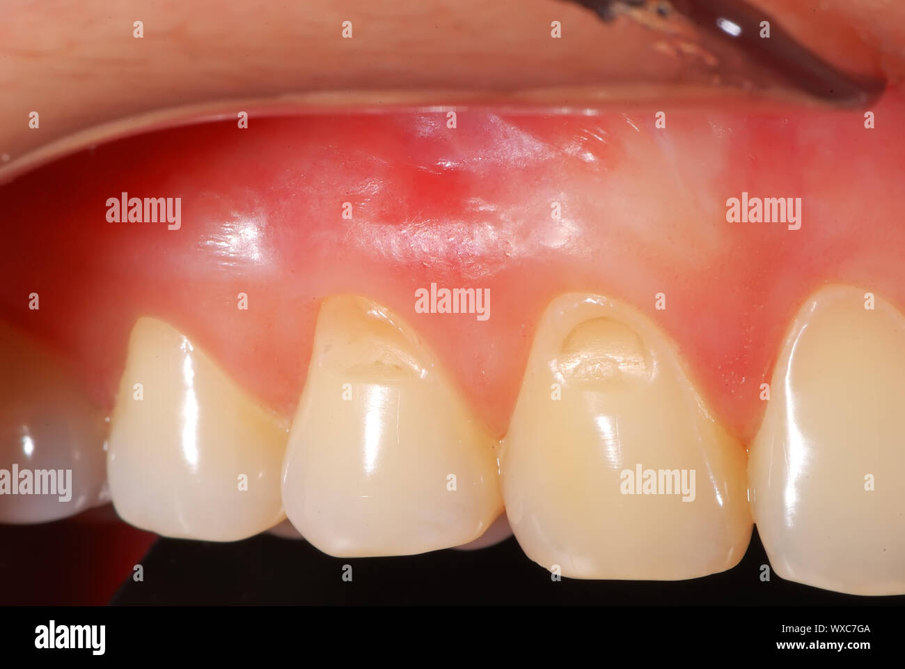 high resolution human teeth, closeup Stock Photo - Alamy