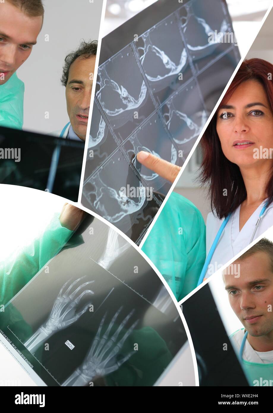 Collage of X-rays Stock Photo - Alamy
