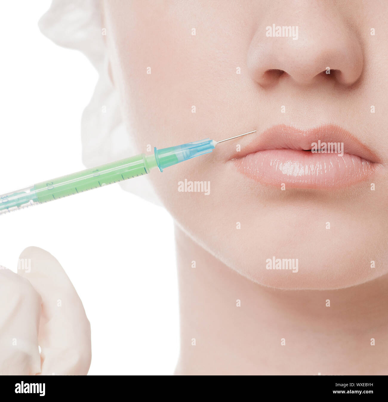 Cosmetic botox injection in the female face. Lips and cheek zone ...