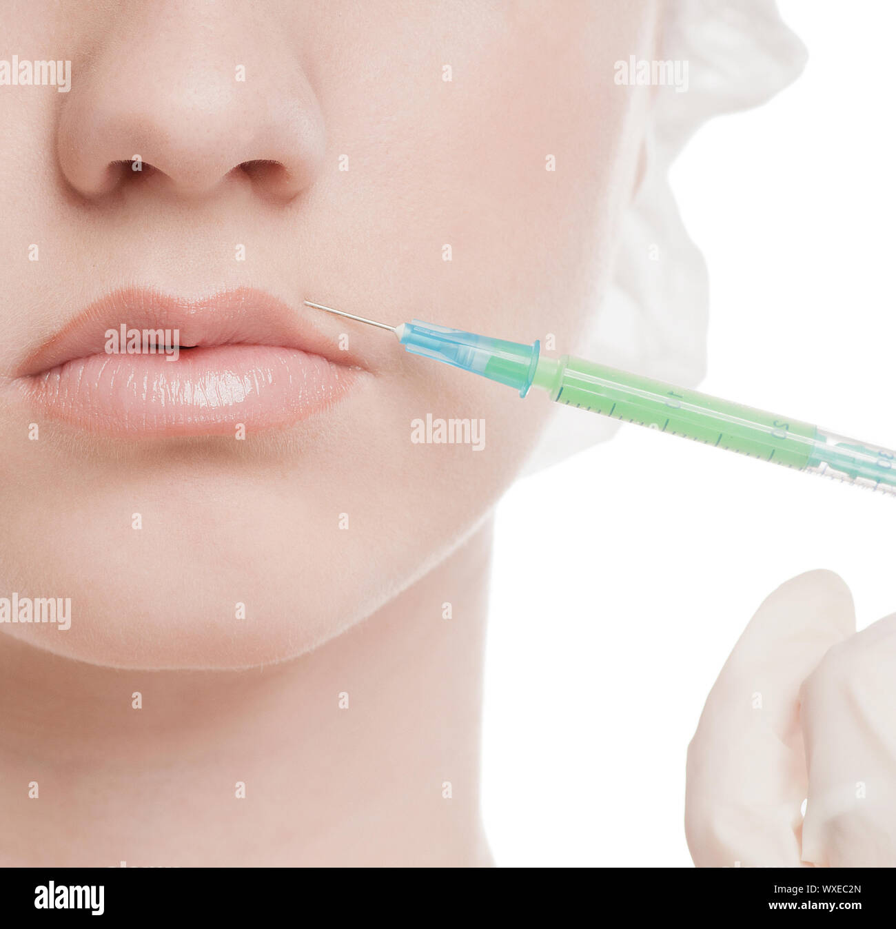 Cosmetic botox injection in the female face. Lips and cheek zone ...