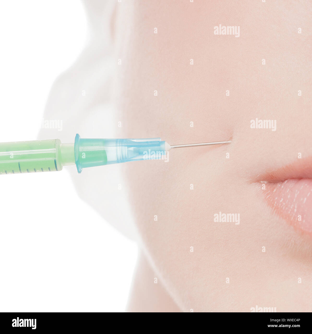 Cosmetic botox injection in the female face. Lips and cheek zone ...