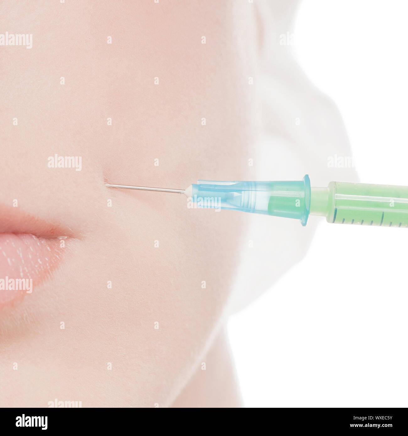Cosmetic botox injection in the female face. Lips and cheek zone ...