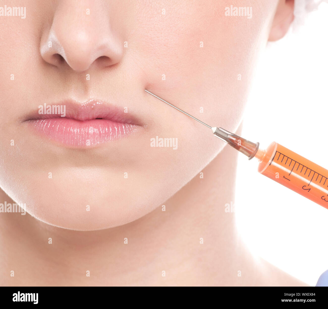 Cosmetic botox injection in the female face. Lips and cheek zone ...