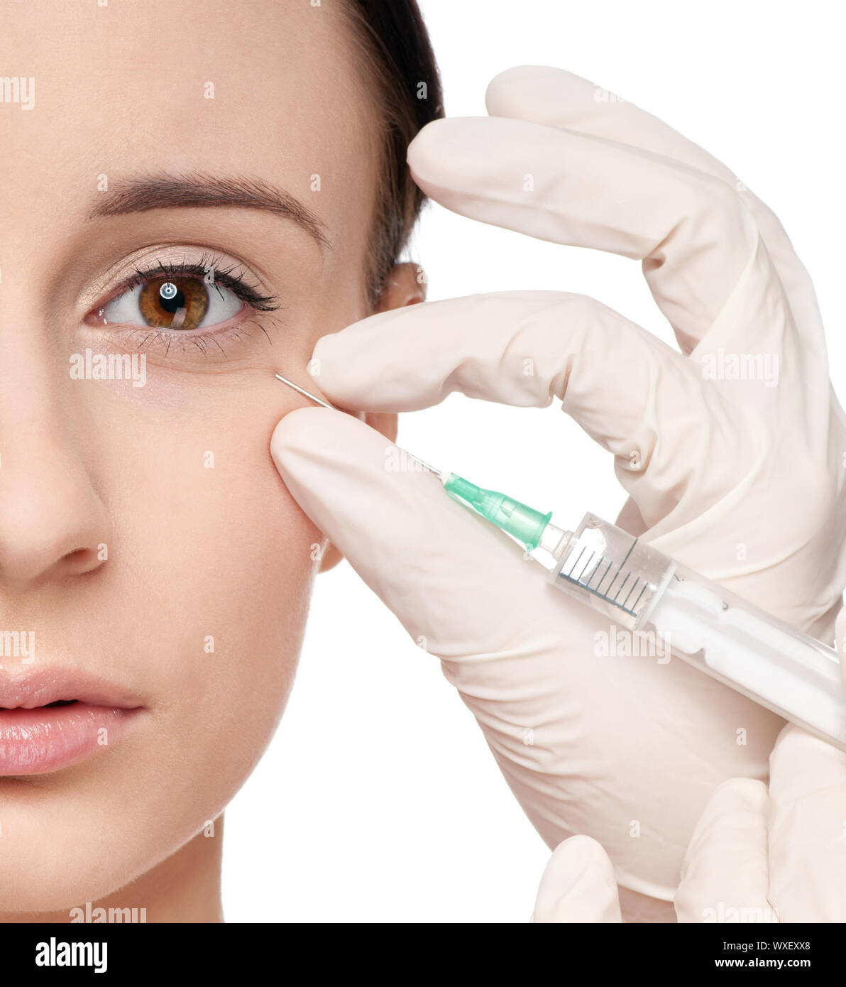Cosmetic botox injection in the female face. Eye zone. Isolated Stock ...