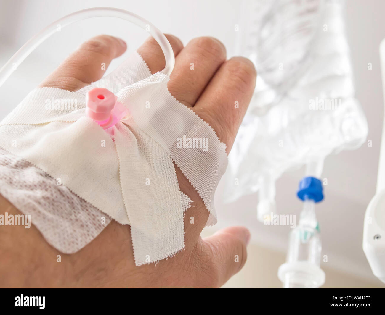 Picture of a hand with infusion bag Stock Photo - Alamy