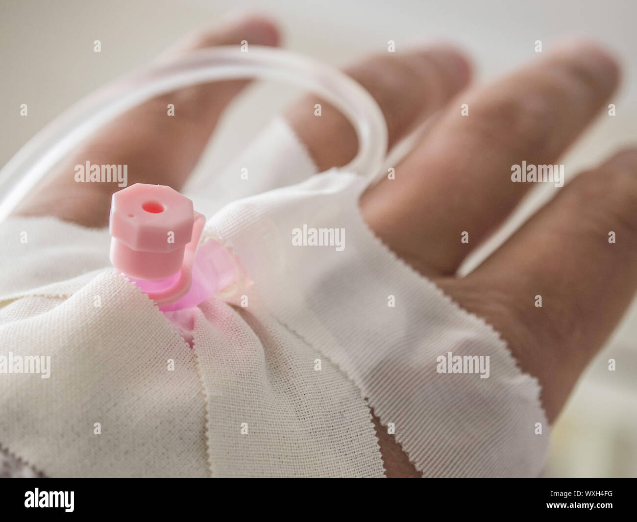 Picture of a hand with infusion needle Stock Photo - Alamy