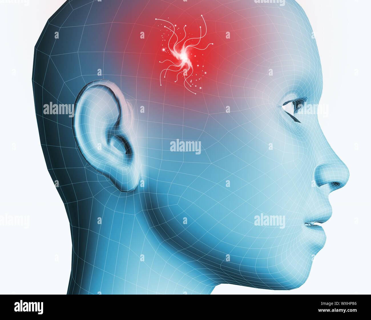 Human headache hi-res stock photography and images - Alamy