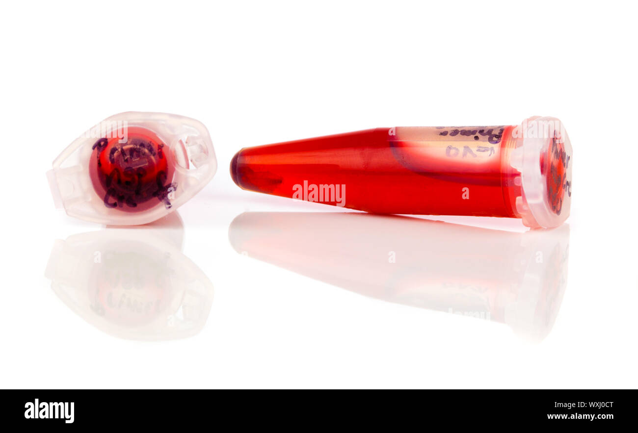 Sample of stem cells in the reaction tube Stock Photo - Alamy