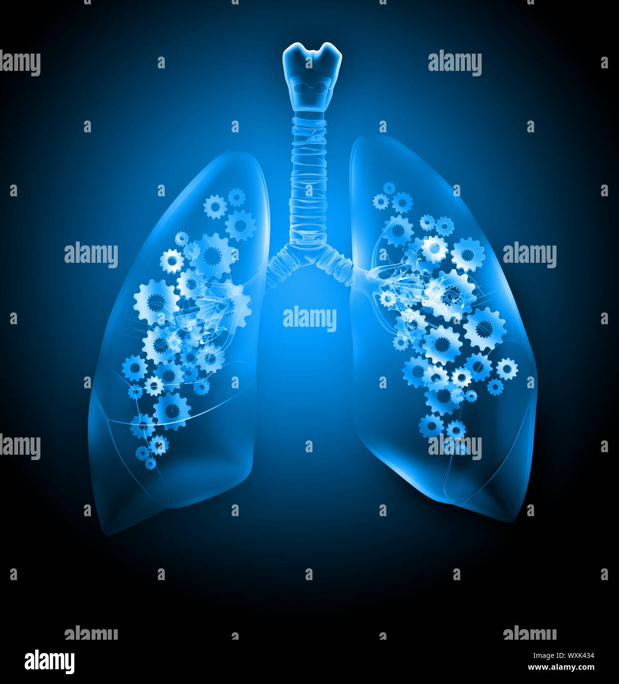 Larynx scan hi-res stock photography and images - Alamy