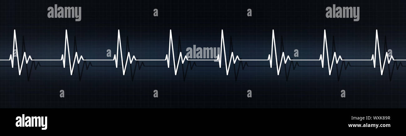 medical banner illustrating. normal heart rateon ecg Stock Photo - Alamy