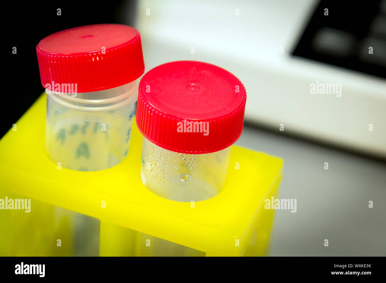 Medical tube with red lid hi-res stock photography and images - Alamy