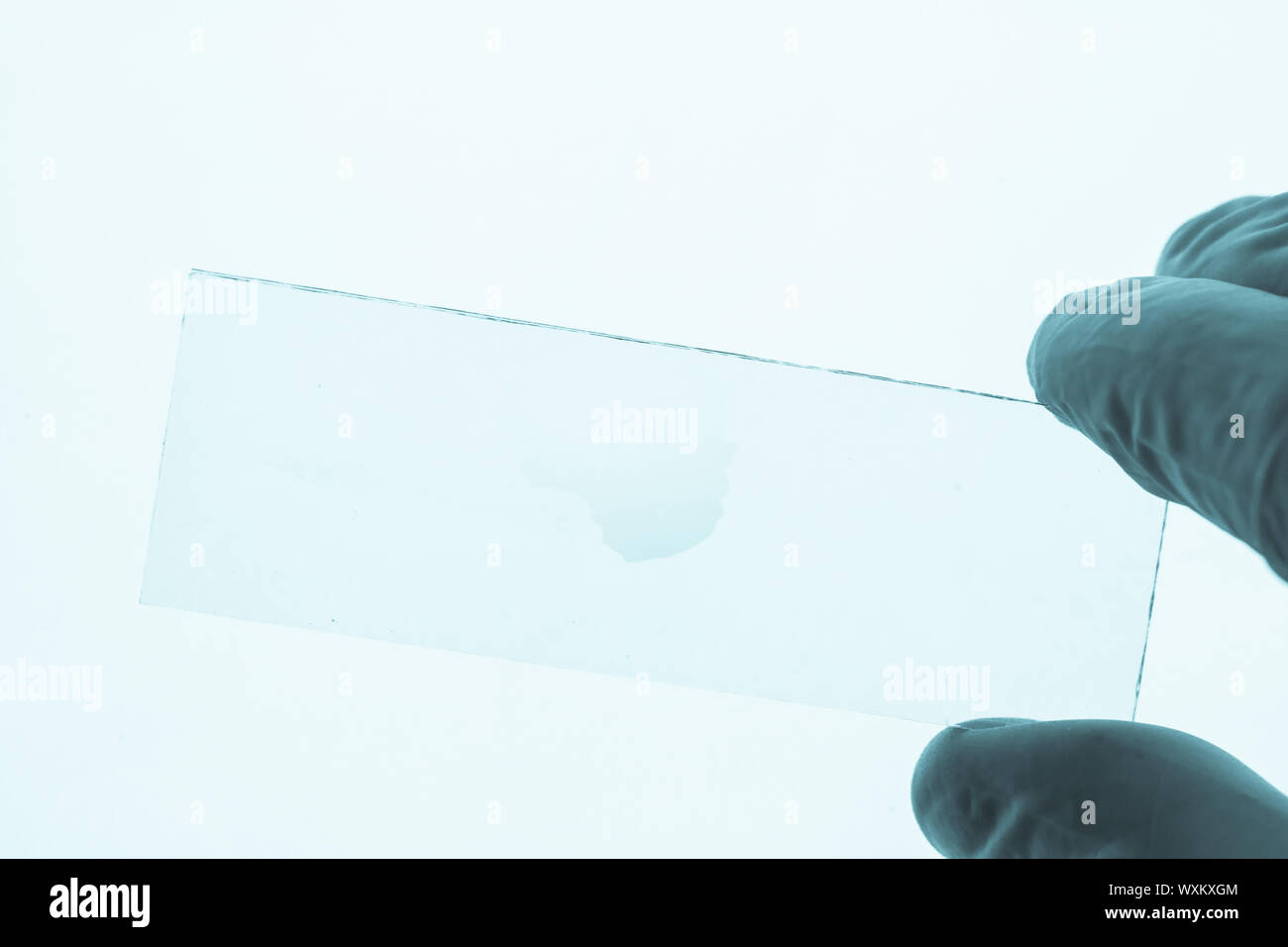 Blue gloved handle holding sample slide for medical research Stock ...