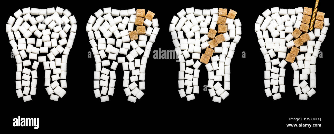 Sugar caries on the tooth presented with cube sugar teeth Stock Photo ...