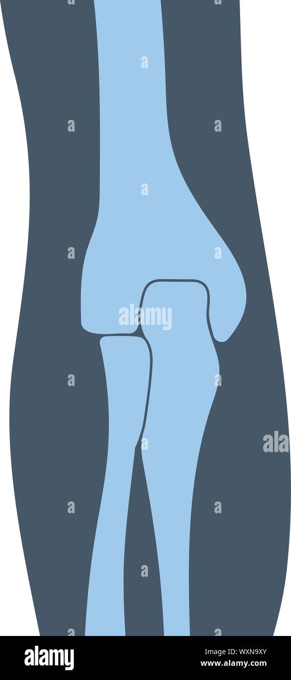 Human elbow joints, emblem or sign of medical diagnostic center or ...