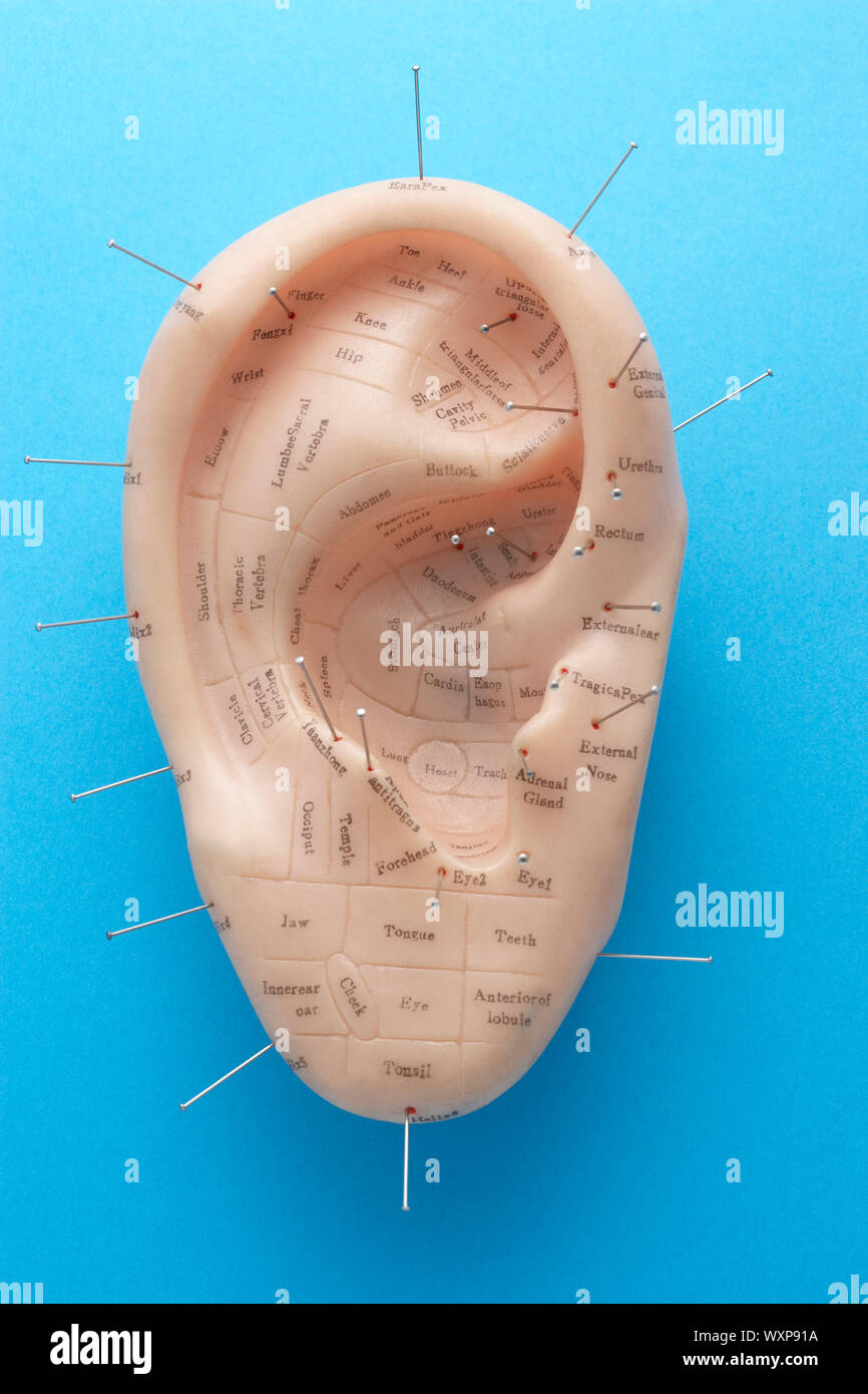 Acupuncture pins hi-res stock photography and images - Alamy