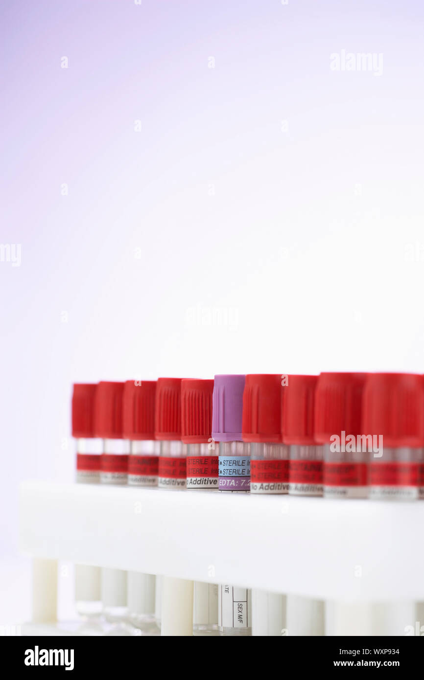 Test tubes with red lids surrounding one with purple lid Stock Photo ...