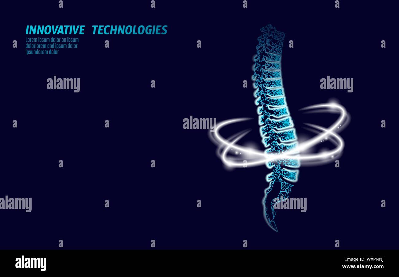 Physiotherapy human spine recovery. Pain area surgery modern loin ...