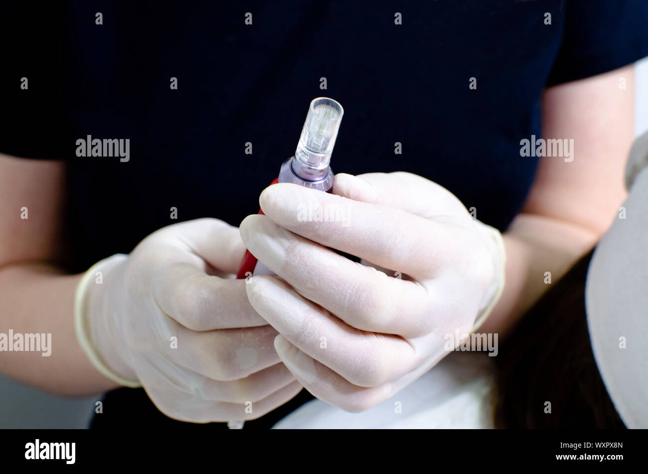 beautician in white gloves holding dermis stamp electric pen,dermapen ...