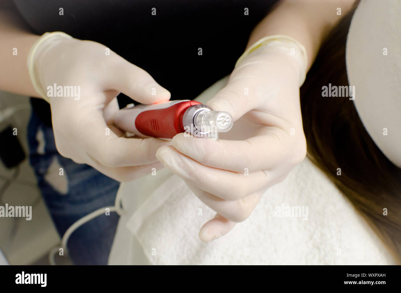 beautician in white gloves holding dermis stamp electric pen,dermapen ...