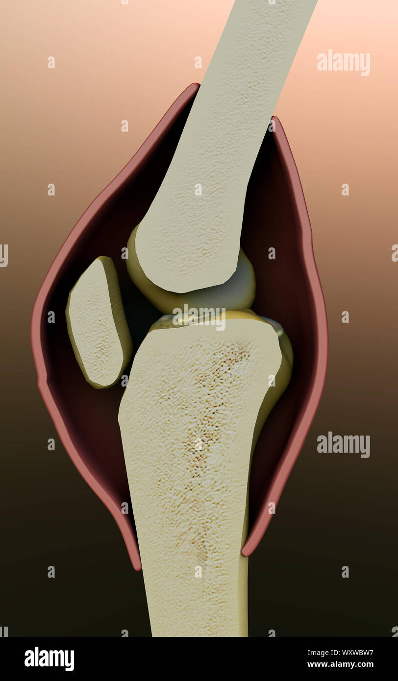 3d rendered knee illustration, pain illustration knee side, 3d ...