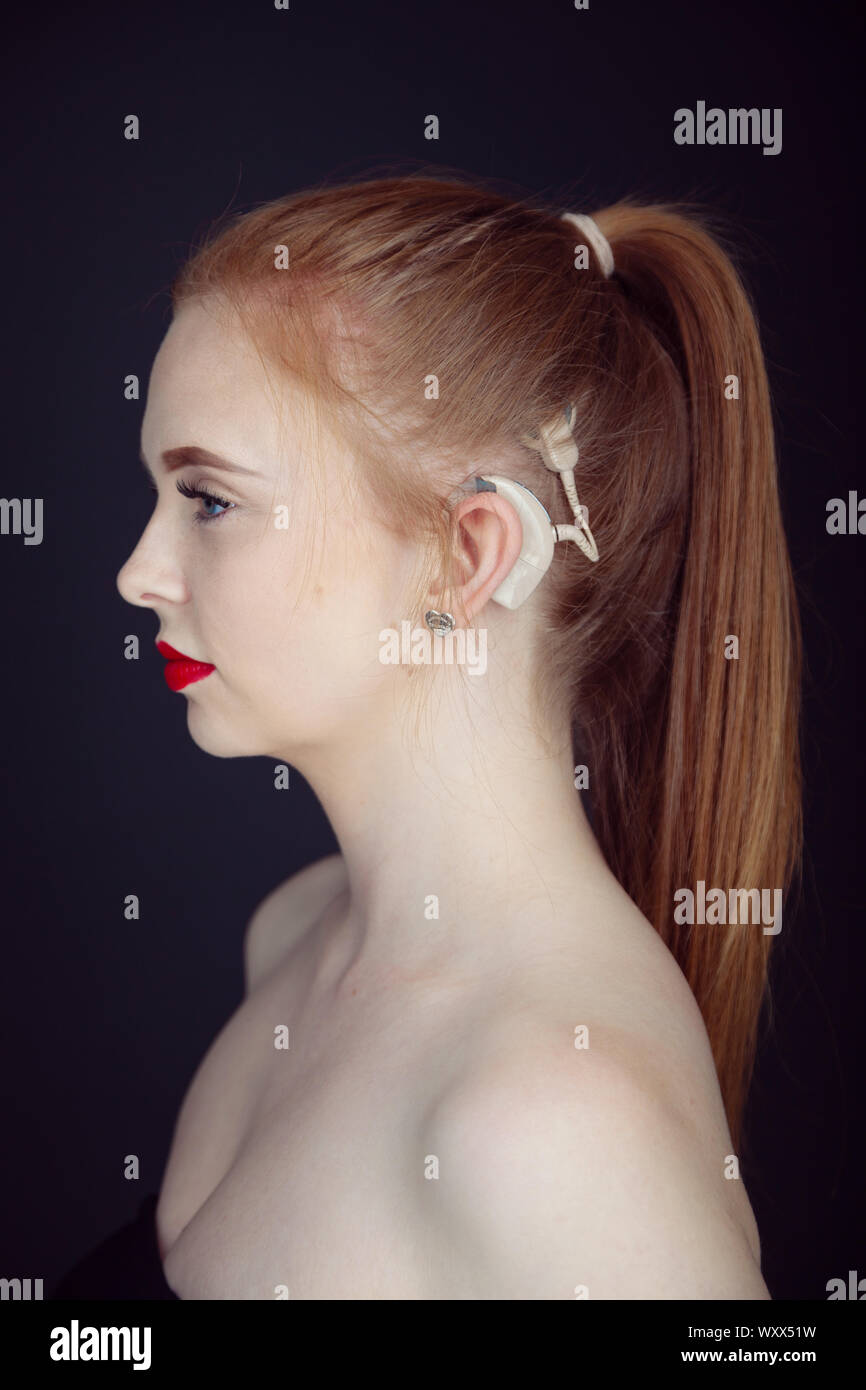 Cochlear implant hi-res stock photography and images - Alamy