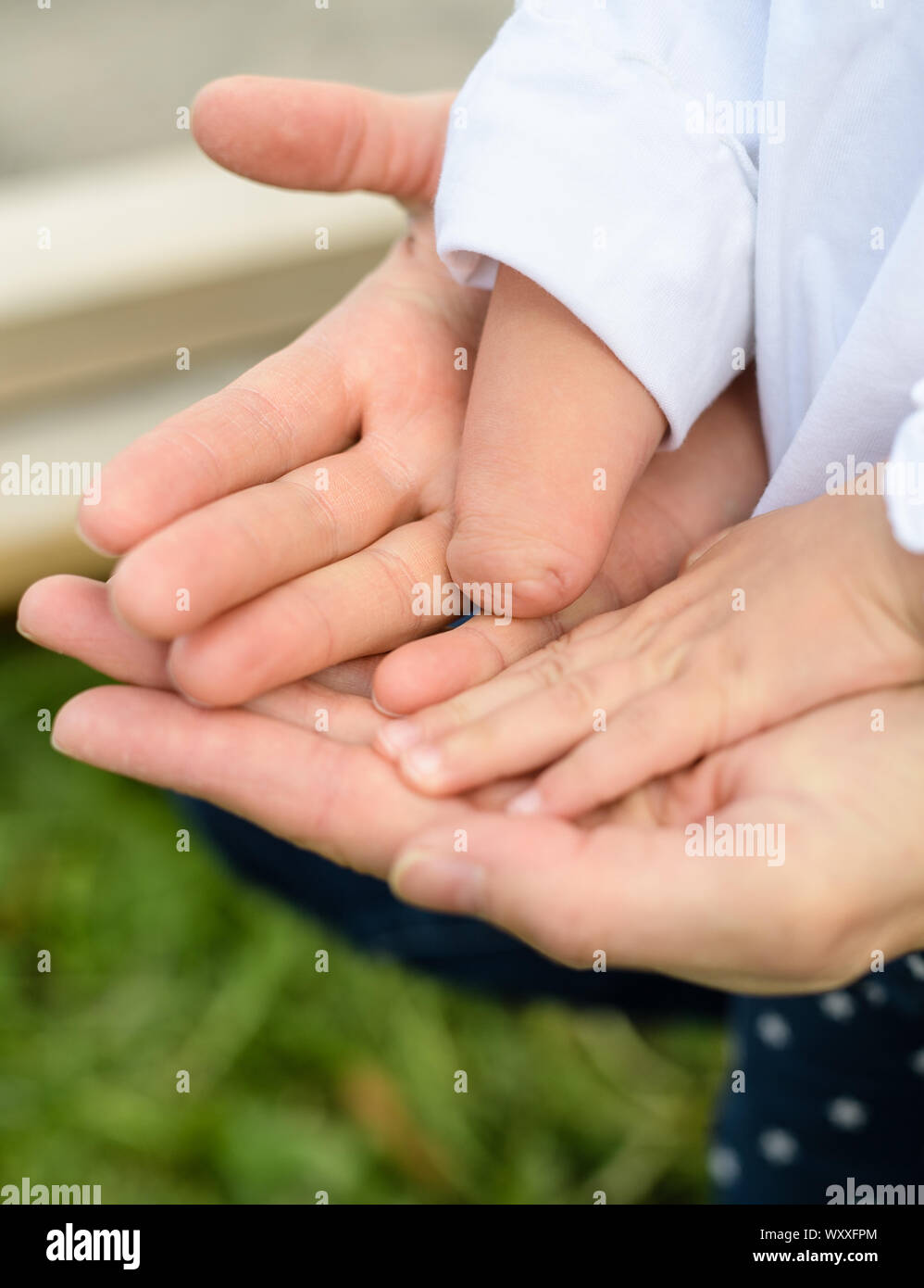 Hand deformities hi-res stock photography and images - Alamy
