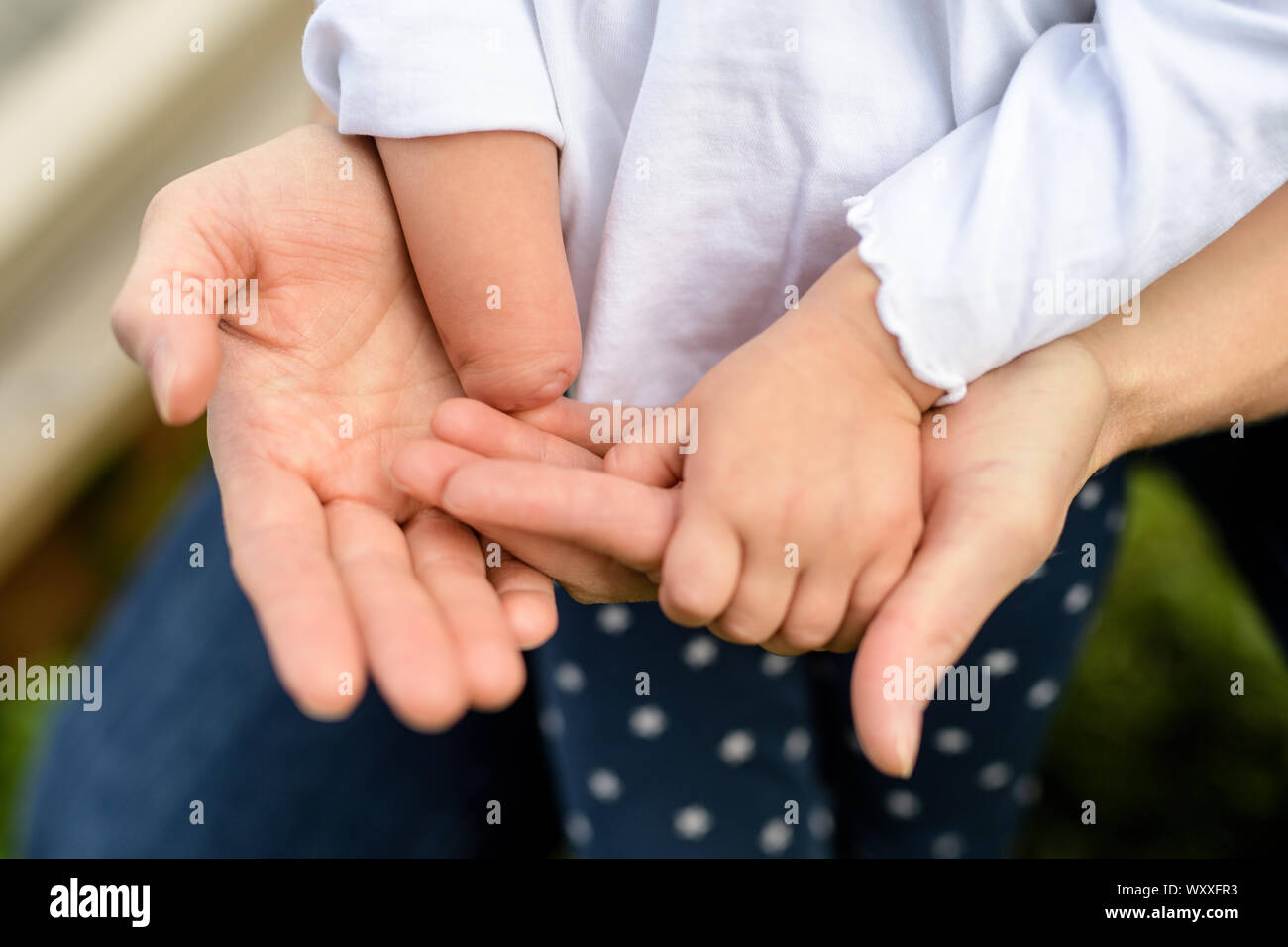 Hand deformities hi-res stock photography and images - Alamy