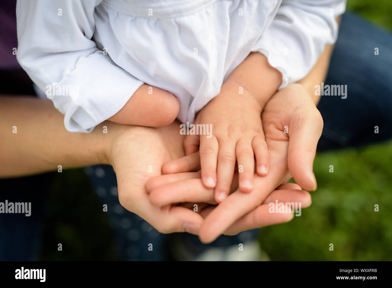 Hand deformities hi-res stock photography and images - Alamy