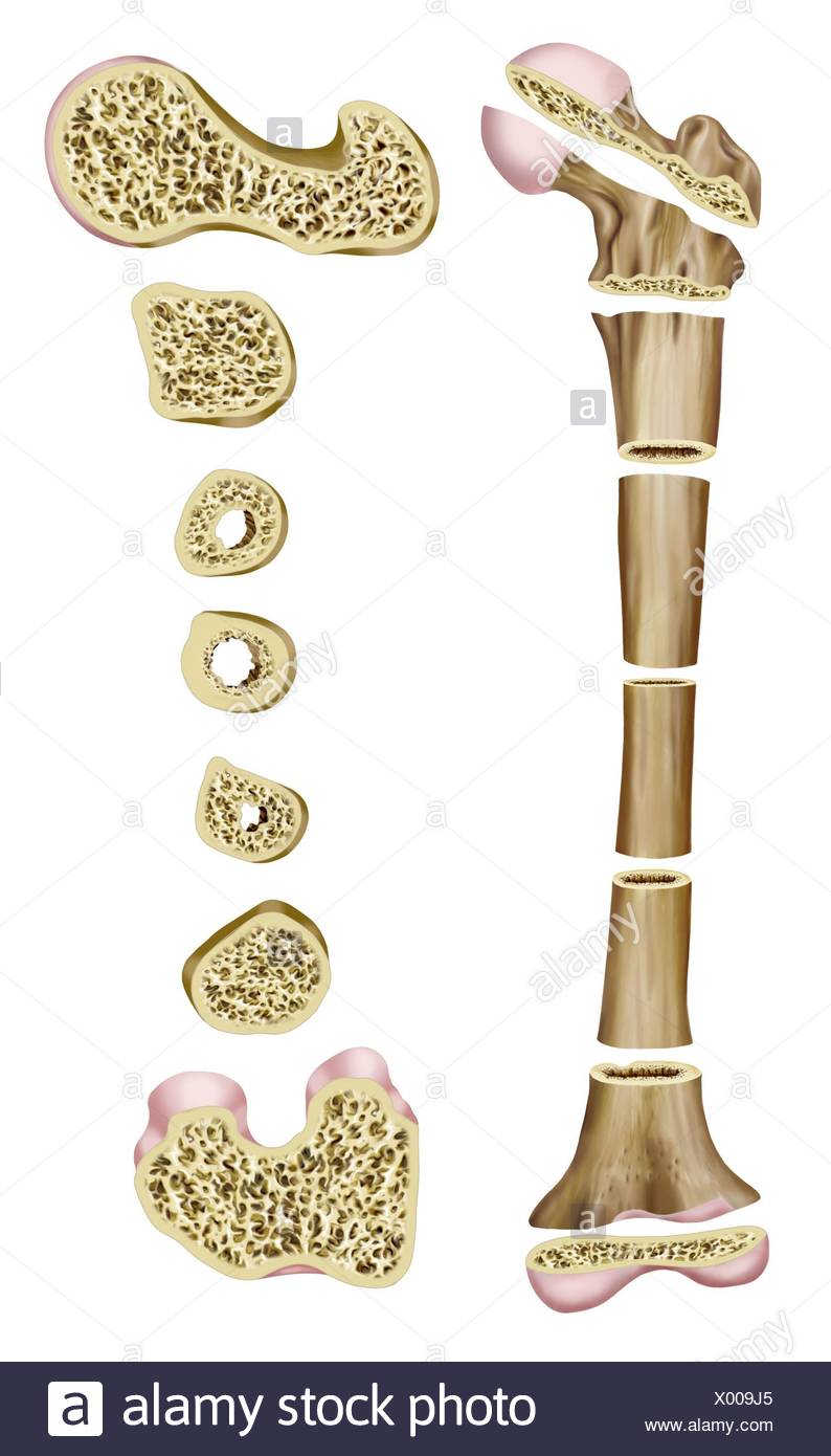 Medullary Cavity Stock Photos & Medullary Cavity Stock Images - Alamy