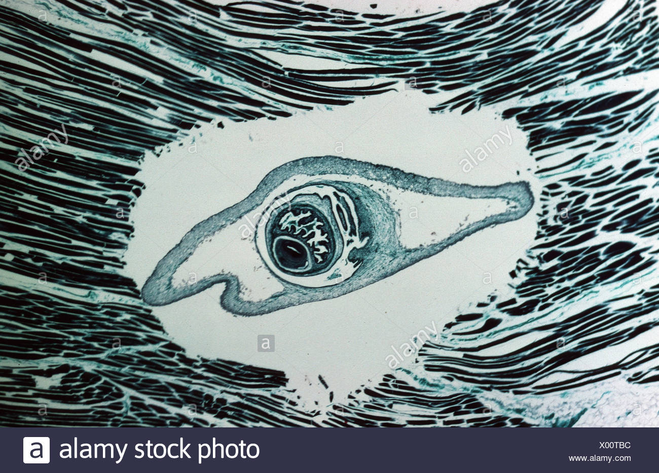 Beef Tapeworm Taenia Saginata Microscopic High Resolution Stock ...