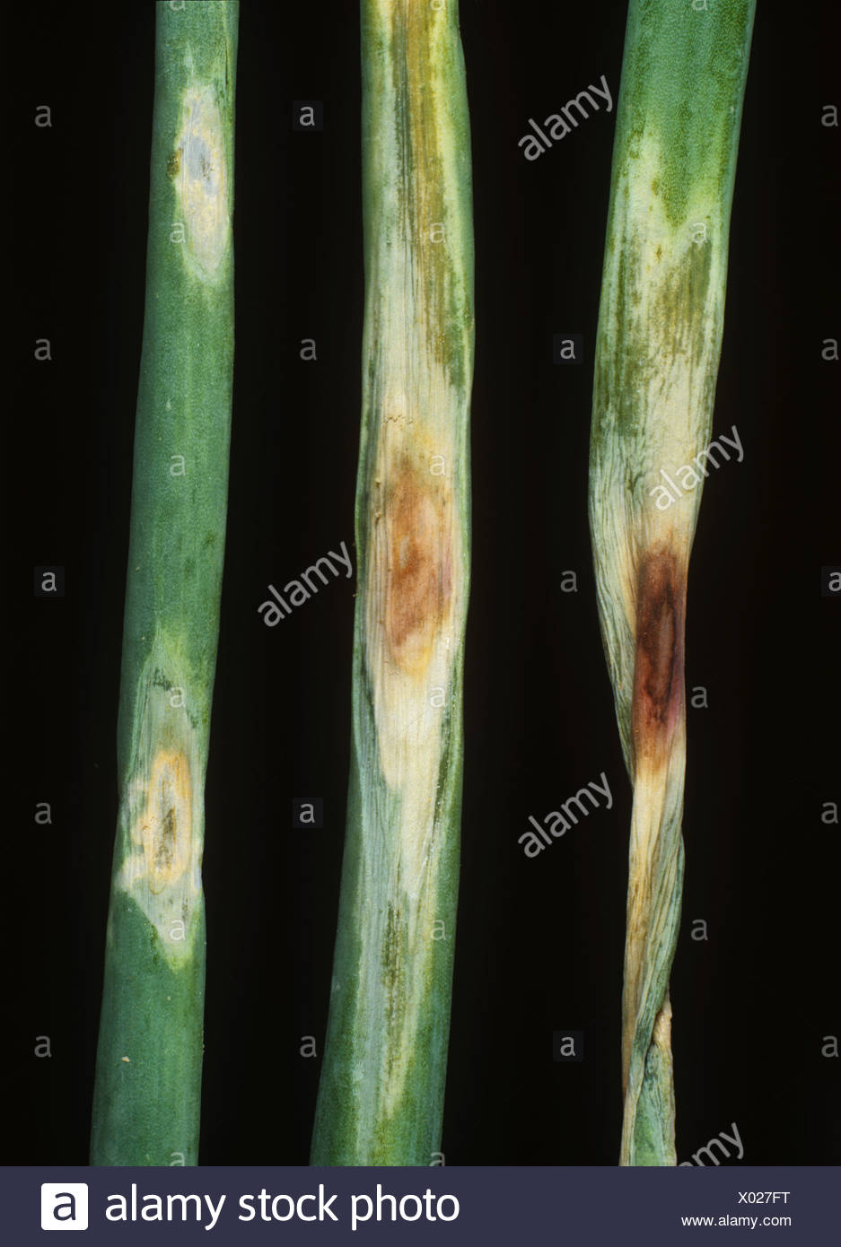 Lesion High Resolution Stock Photography and Images - Alamy