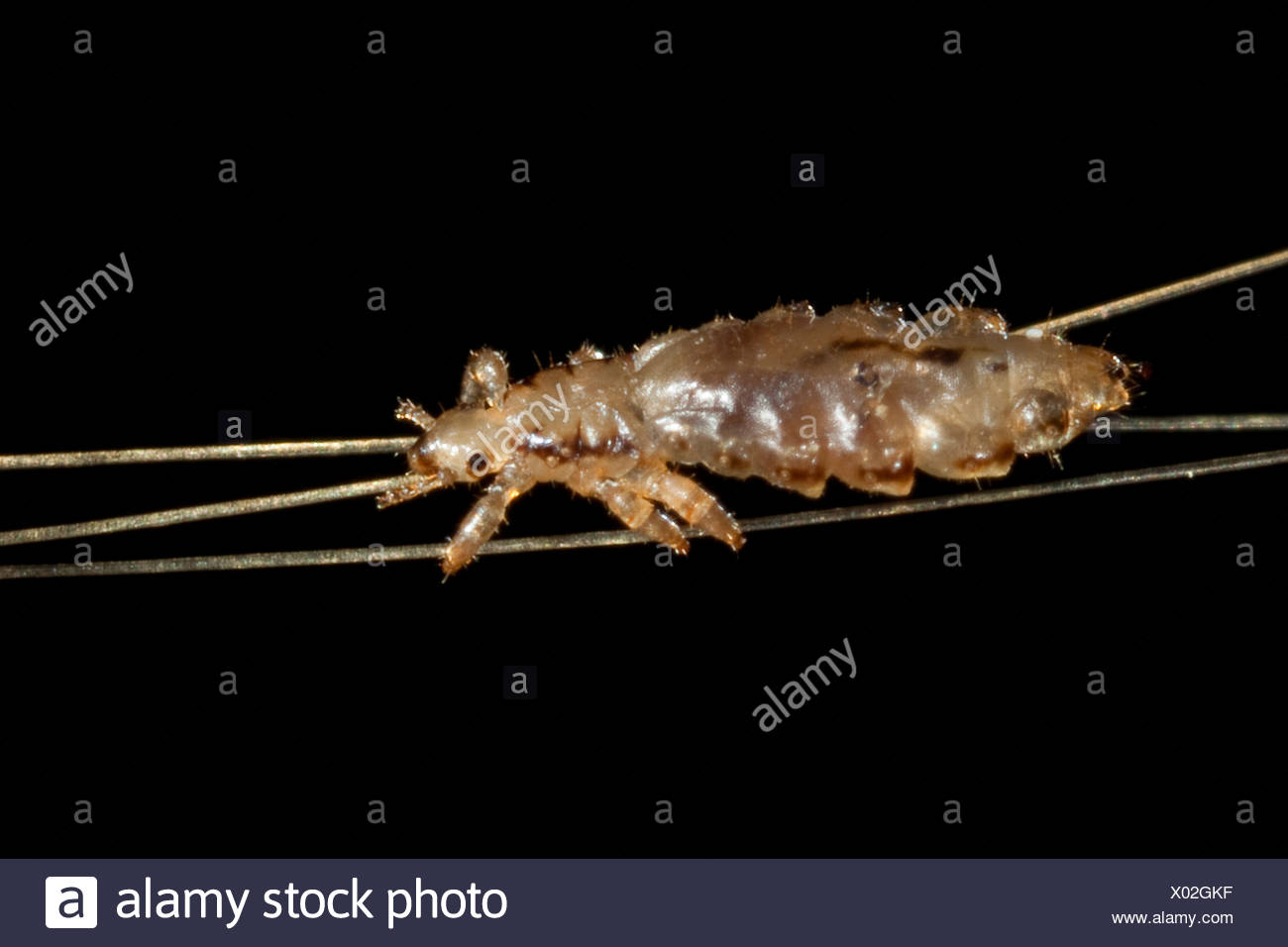 Pediculus Humanus Head Louse High Resolution Stock Photography and ...