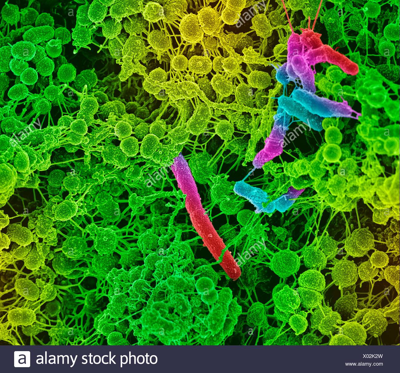 Streptococcus Sem High Resolution Stock Photography and Images - Alamy