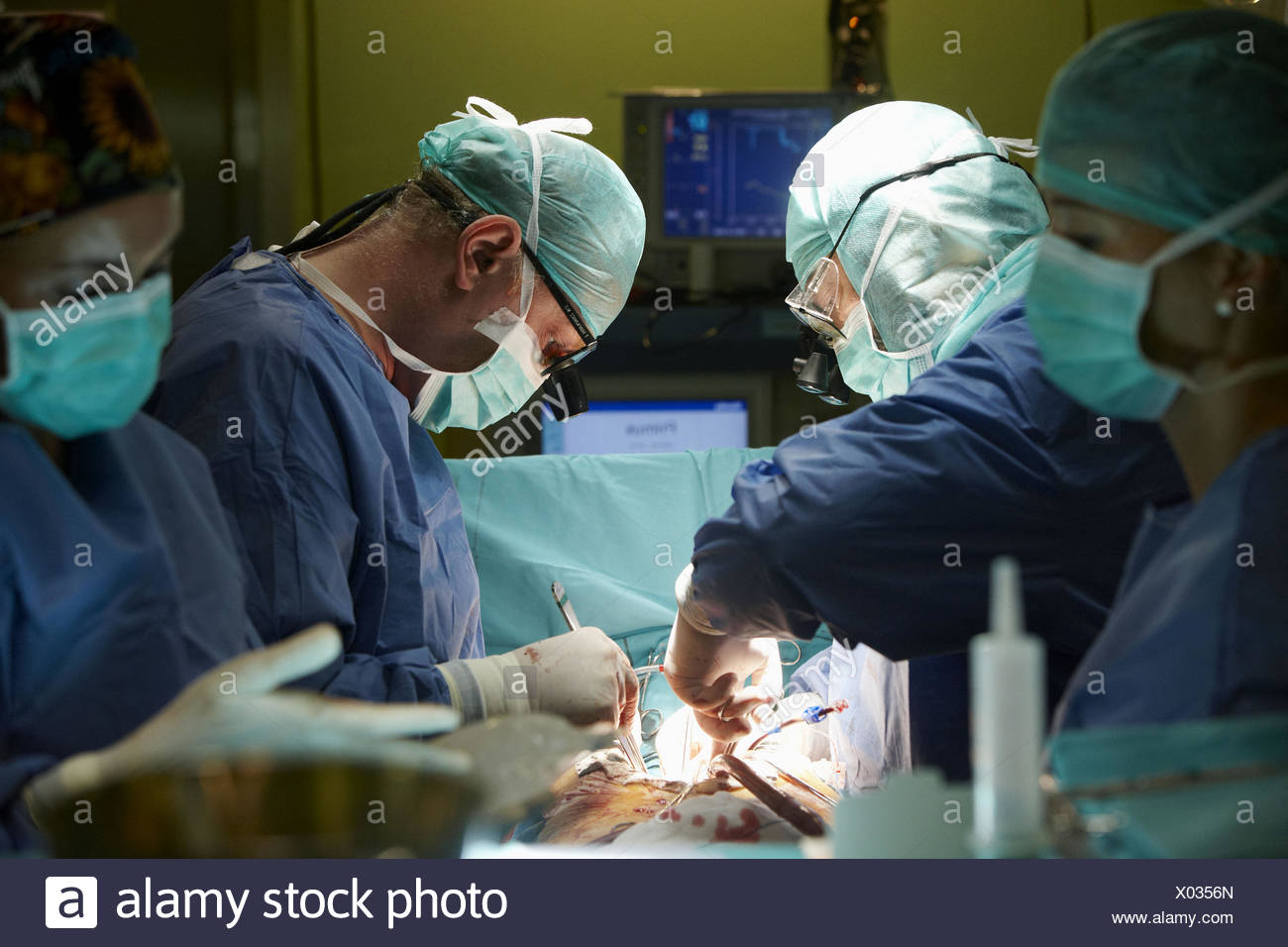 Human Heart Aortic Valve High Resolution Stock Photography and Images ...