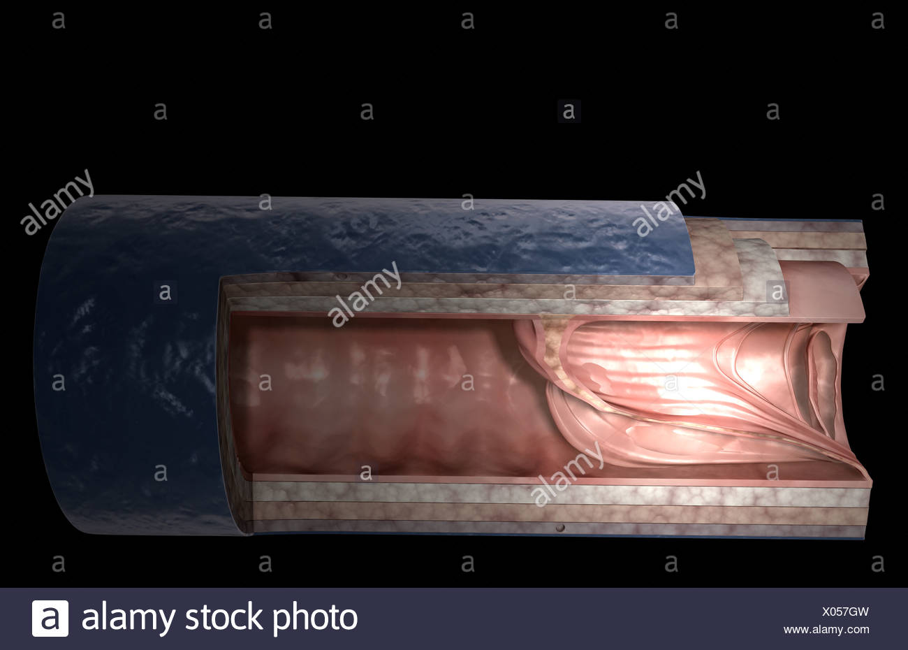 Blood Vessel Lumen High Resolution Stock Photography and Images - Alamy