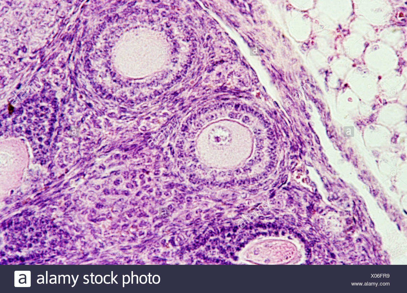 Histology Ovary Stock Photos & Histology Ovary Stock Images - Alamy
