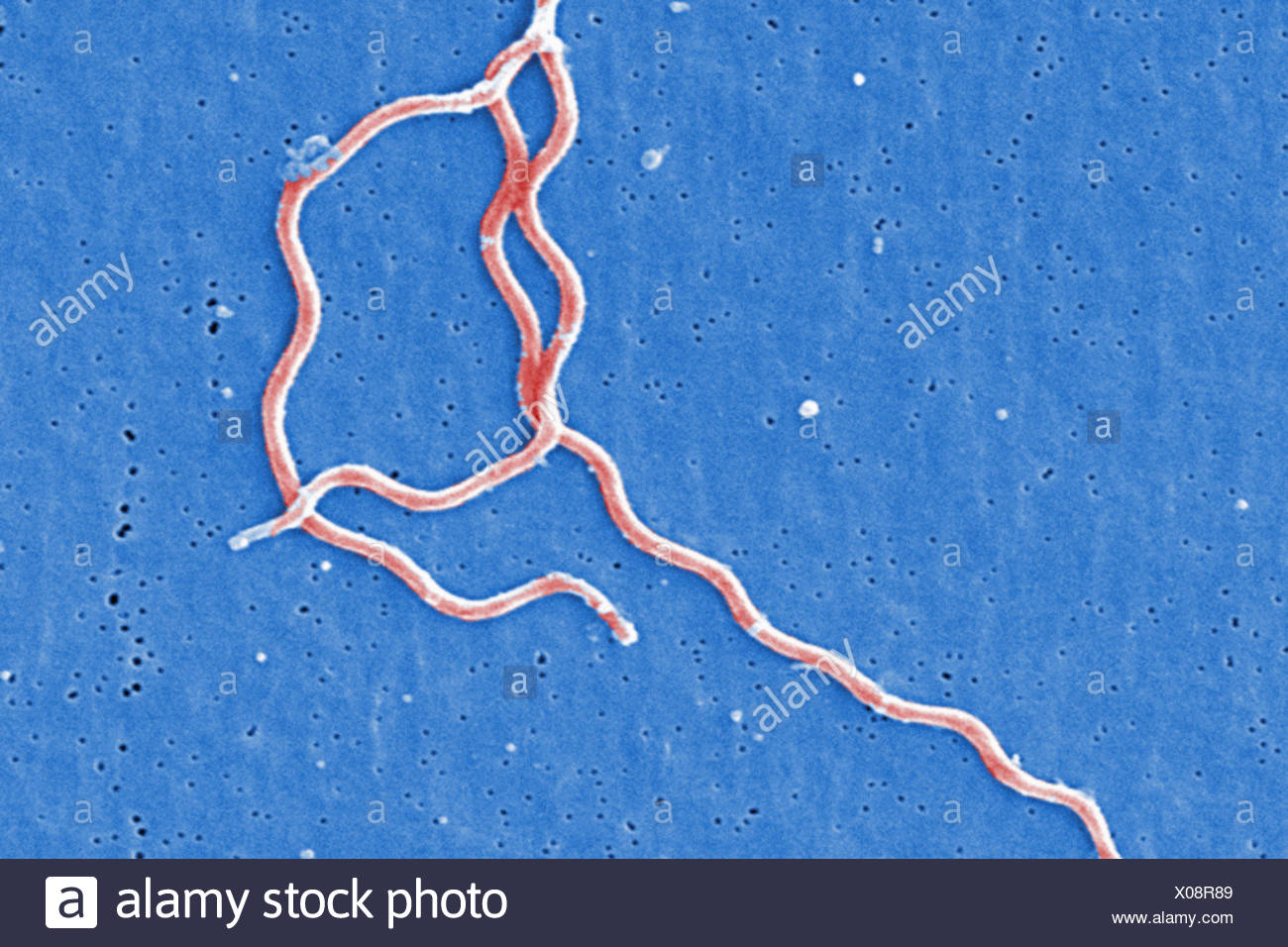 Borrelia Burgdorferi High Resolution Stock Photography and Images - Alamy