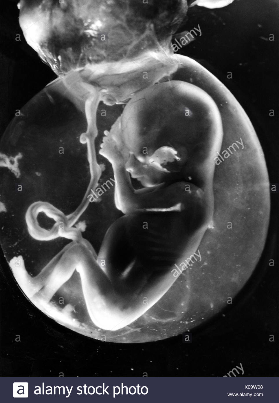 Amniotic Sac High Resolution Stock Photography and Images - Alamy