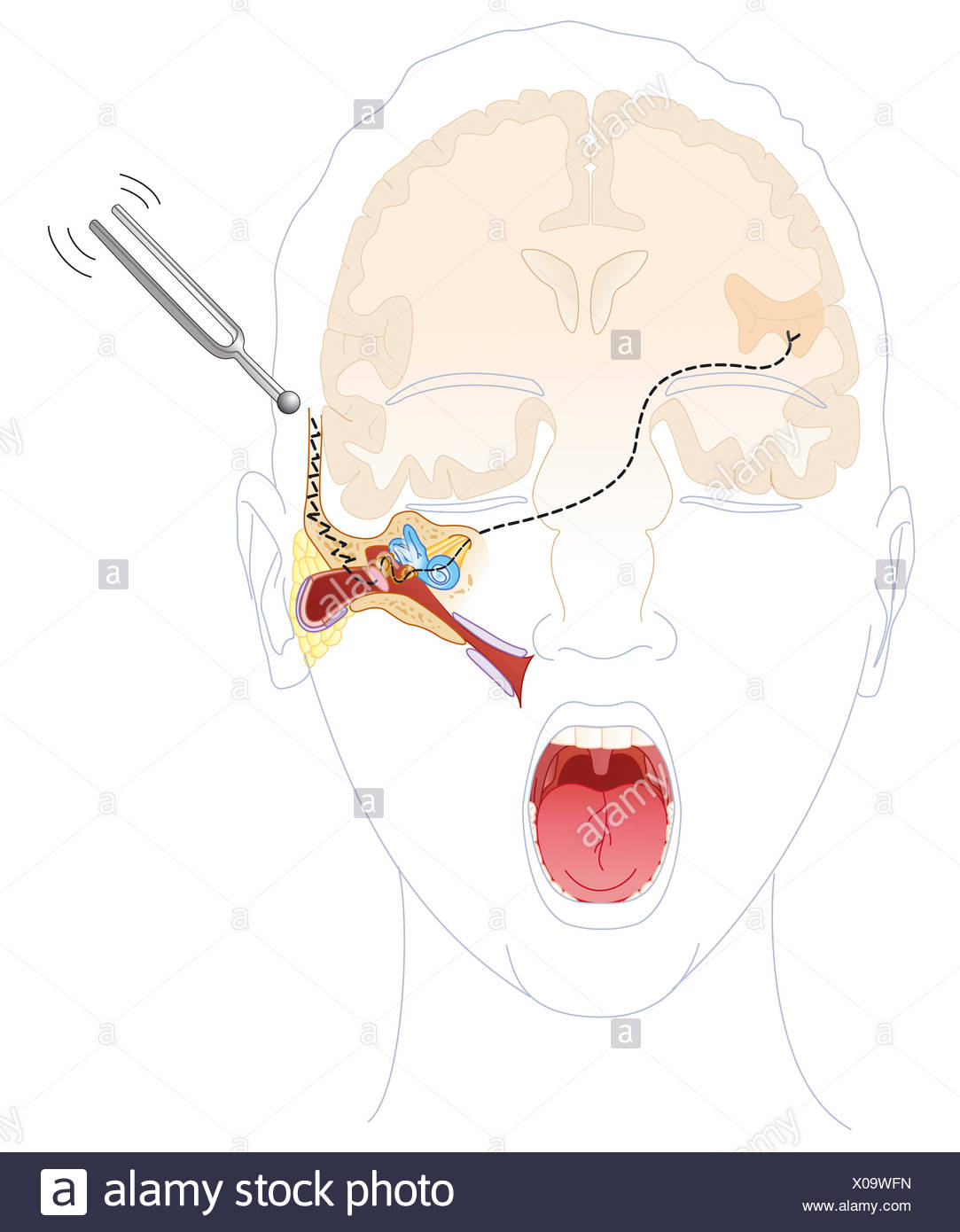 Auditory Cortex High Resolution Stock Photography and Images - Alamy