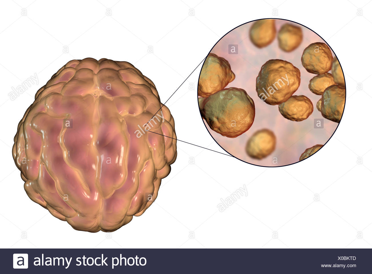 Cryptococcus Neoformans High Resolution Stock Photography and Images ...