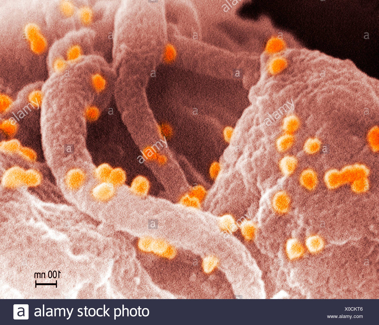 Human Immunodeficiency Virus 1 High Resolution Stock Photography and ...