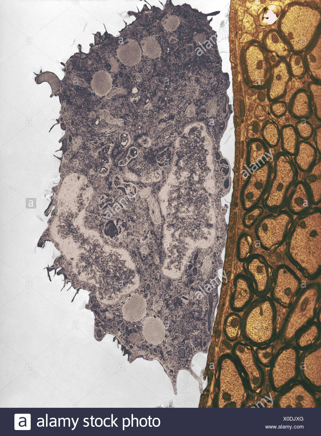 Orientia Tsutsugamushi Rickettsia High Resolution Stock Photography and ...