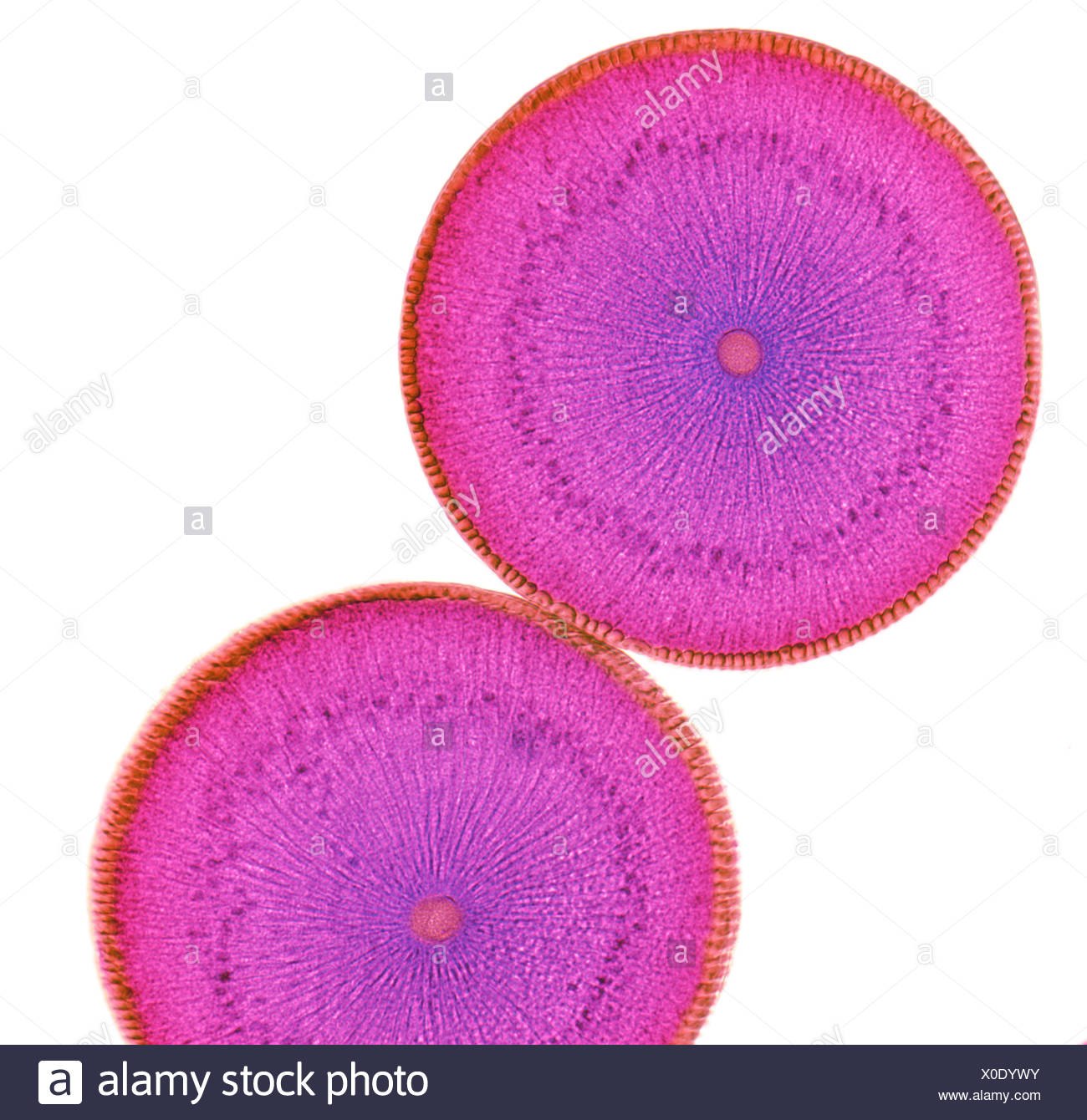 Ovary Micrograph High Resolution Stock Photography and Images - Alamy Ovary Micrograph High Resolution Stock Photography and Images - Alamy