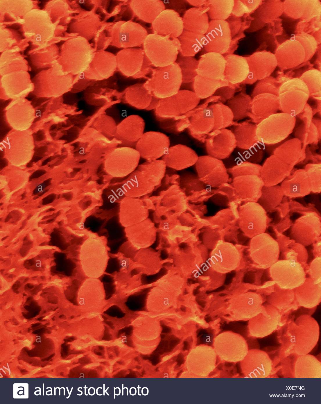 Anaerobic Streptococcus High Resolution Stock Photography and Images ...