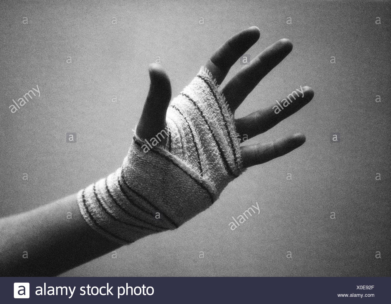Bandaged Hand Stock Photos & Bandaged Hand Stock Images - Alamy